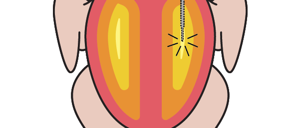 Proper Thermometer Probe Placement in Turkeys